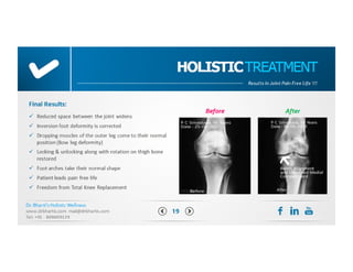 Osteo-Arthritis Information Booklet | PDF