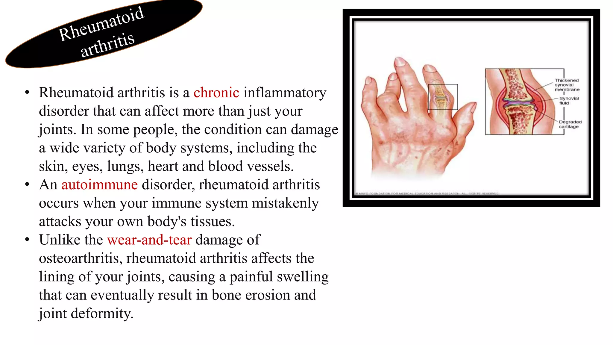 Joint and Joint dissorders.pptx