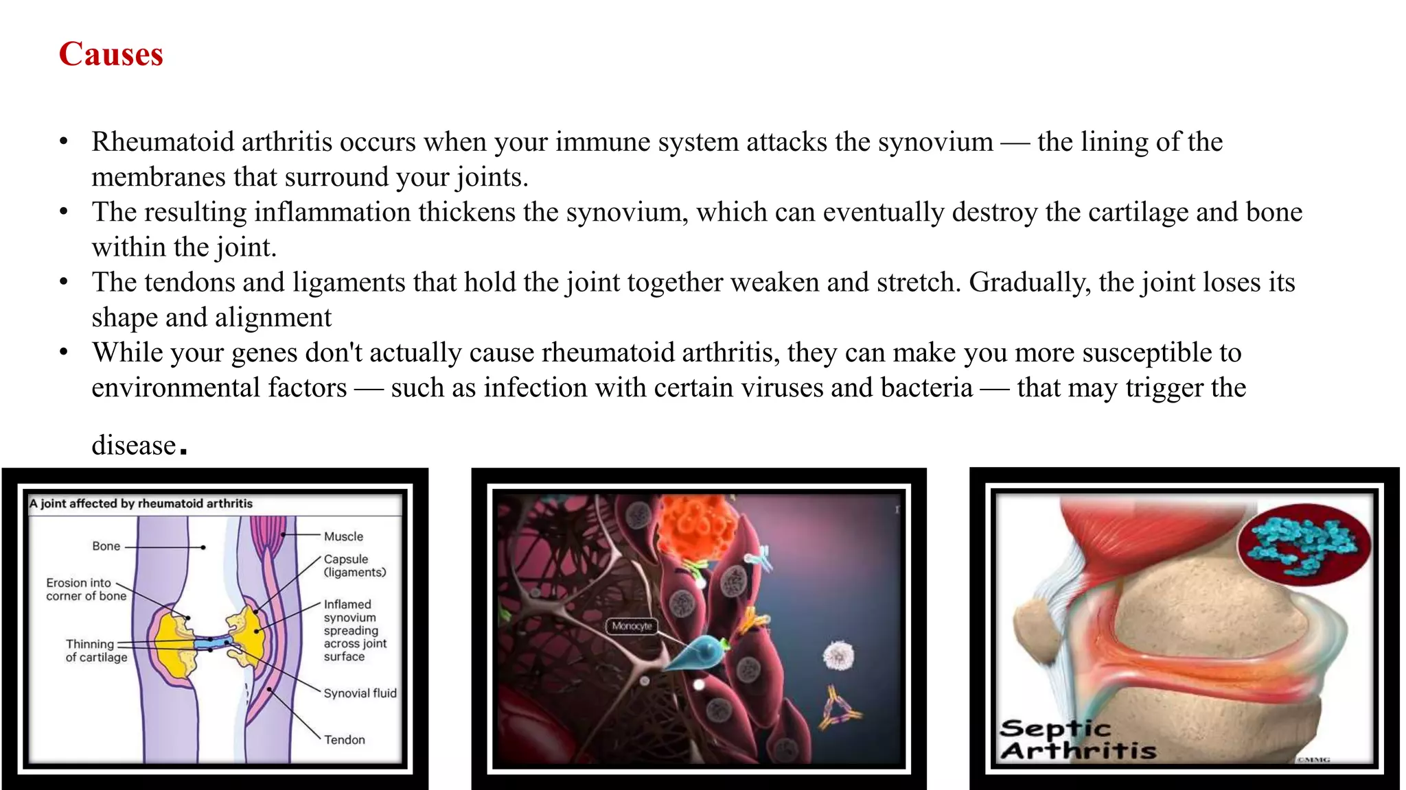 Joint and Joint dissorders.pptx