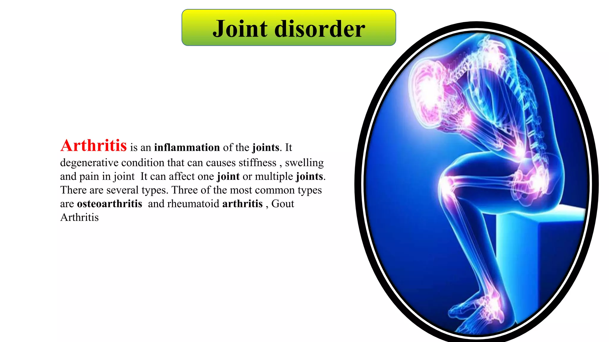 Joint and Joint dissorders.pptx