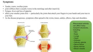 Joint and Joint dissorders.pptx