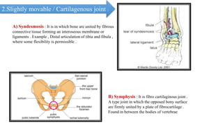 Joint and Joint dissorders.pptx