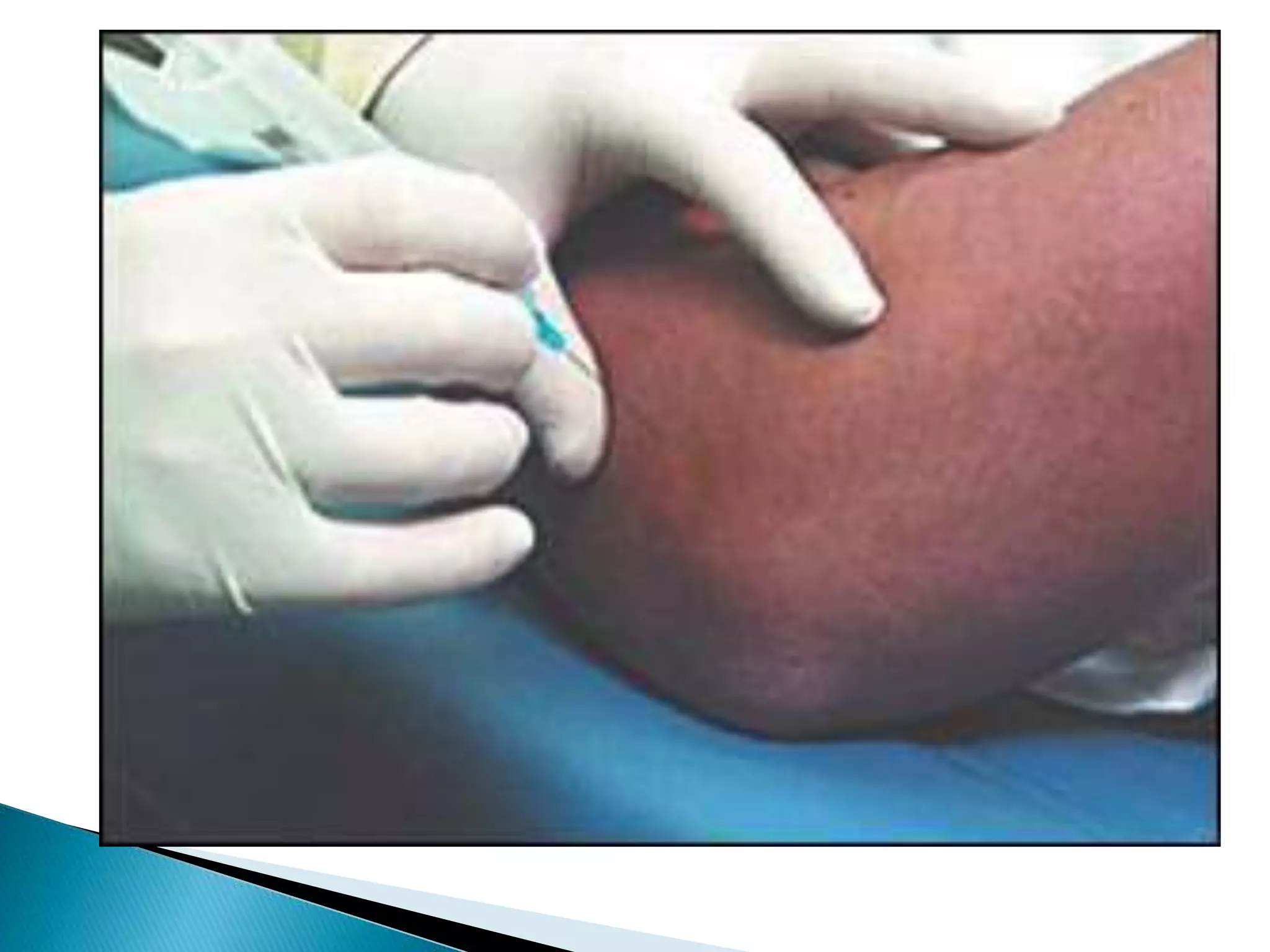 Joint and soft tissue injections | PPTX