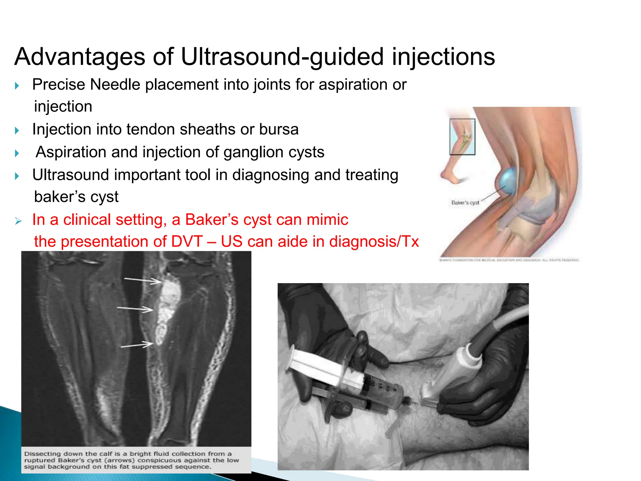 Joint Aspiration and Injection Techniques Powerpoint | PPTX
