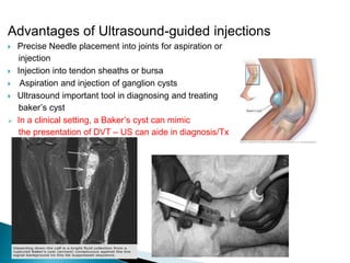 Joint Aspiration and Injection Techniques Powerpoint | PPTX