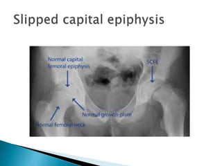 Joint Aspiration and Injection Techniques Powerpoint | PPTX