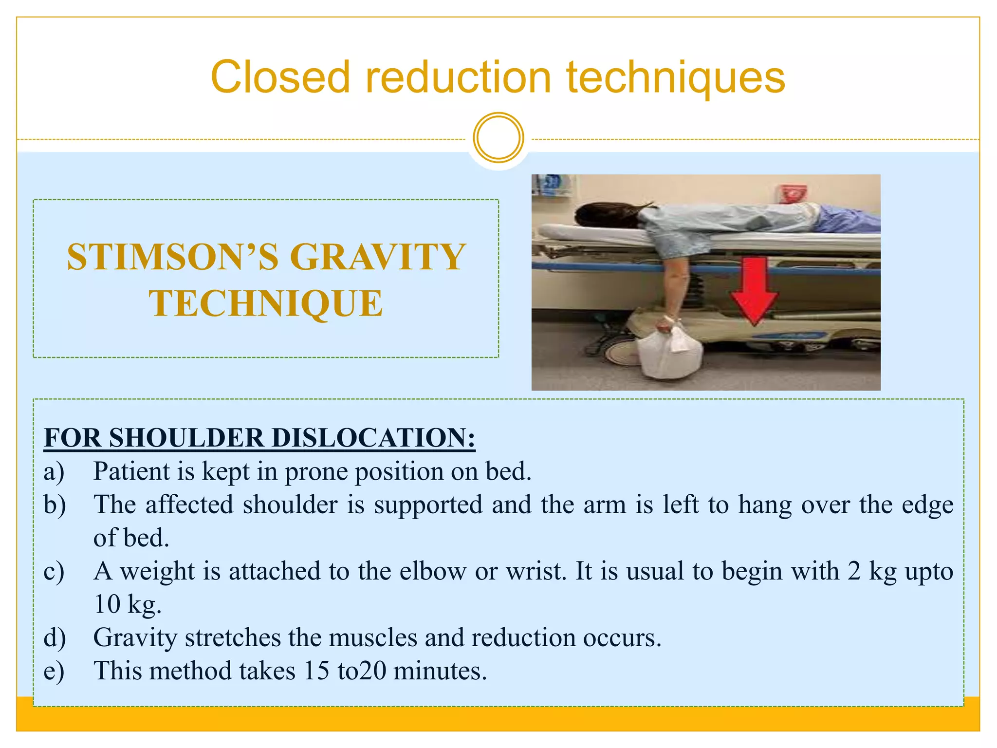 Joint dislocation | PPTX