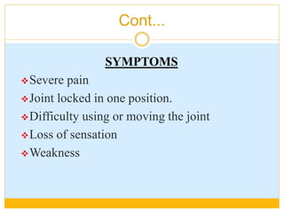 Joint dislocation | PPTX