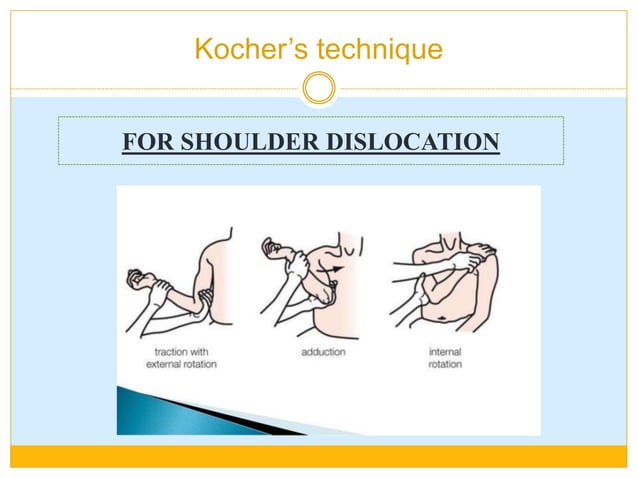 Joint dislocation | PPTX | First Aid | Injuries
