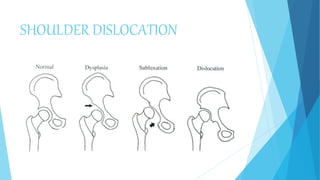 JOINT DISLOCATION.pptx
