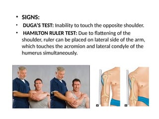 Dislocation of major joints ( Shoulder , hip and knee) | PPTX