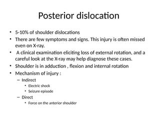Dislocation of major joints ( Shoulder , hip and knee) | PPTX