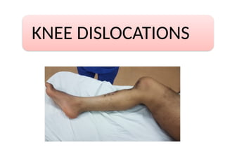 Dislocation of major joints ( Shoulder , hip and knee) | PPTX