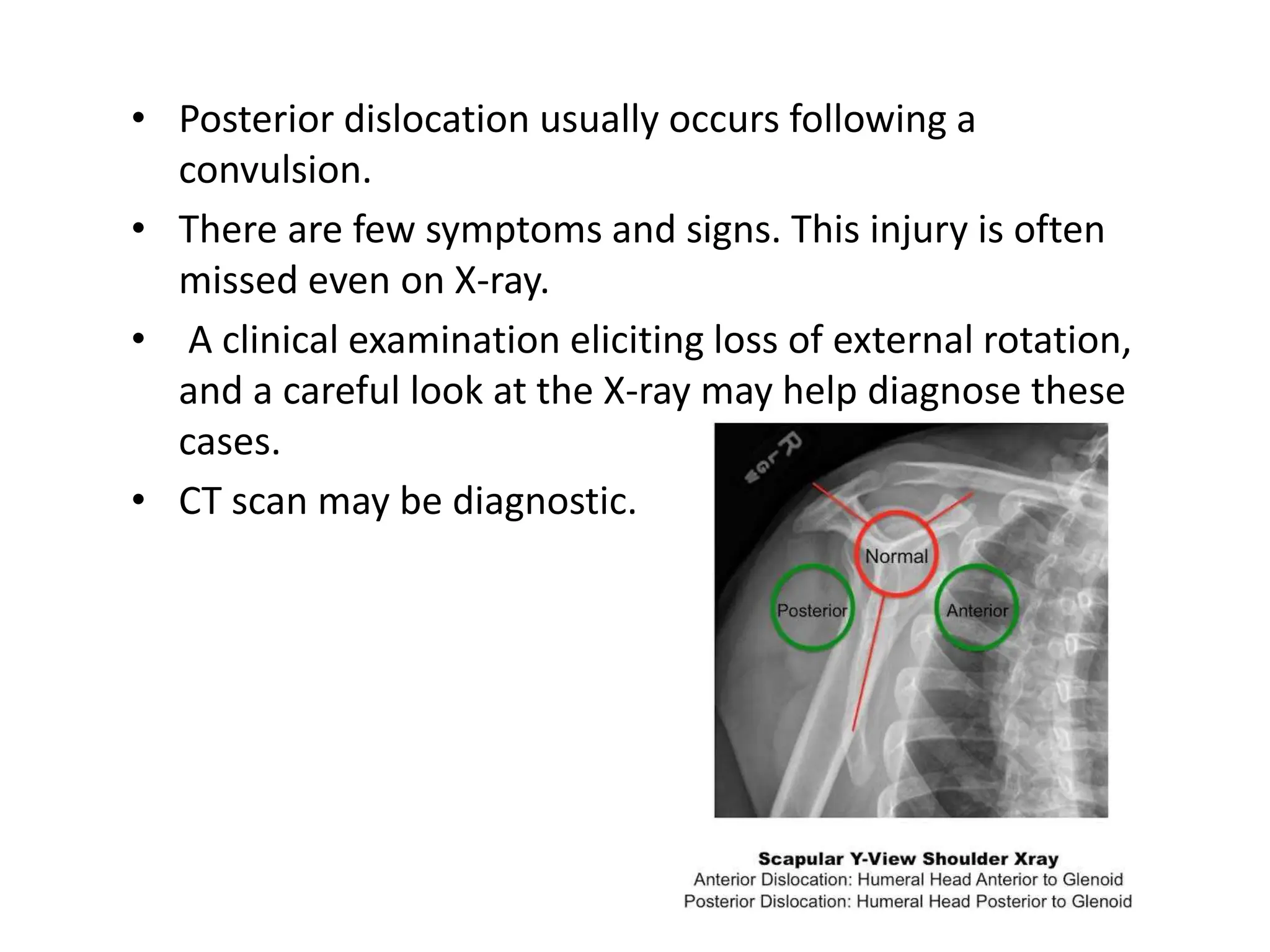 JOINT DISLOCATION of hip knee and shoulder PART-2.pptx