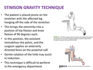 JOINT DISLOCATION of hip knee and shoulder PART-2.pptx
