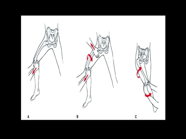 Joint dislocations | PPTX | Death, Injury, or Military Conflict ...