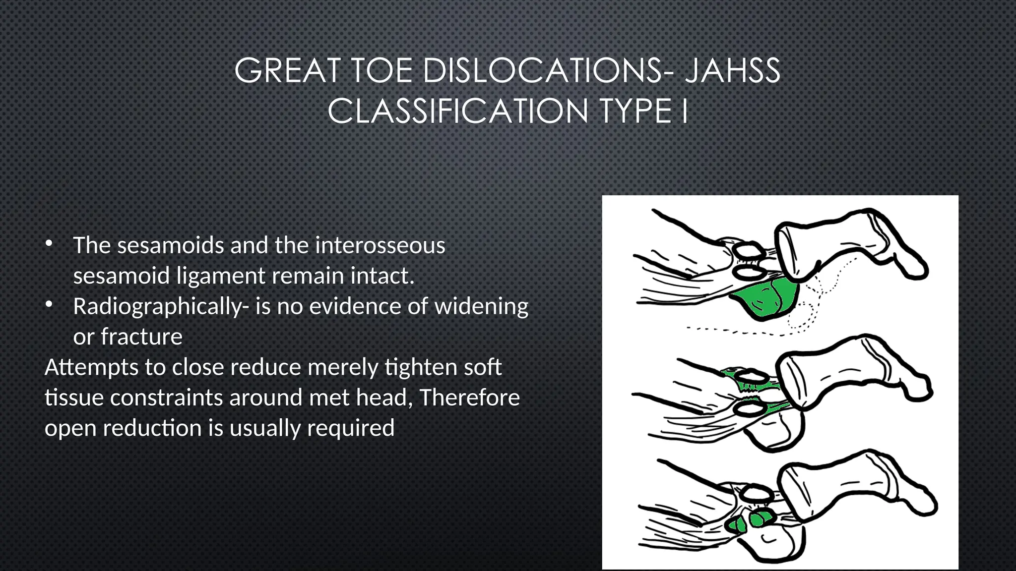 Joint dislocations and Open fractures ch 96, 102.pptx
