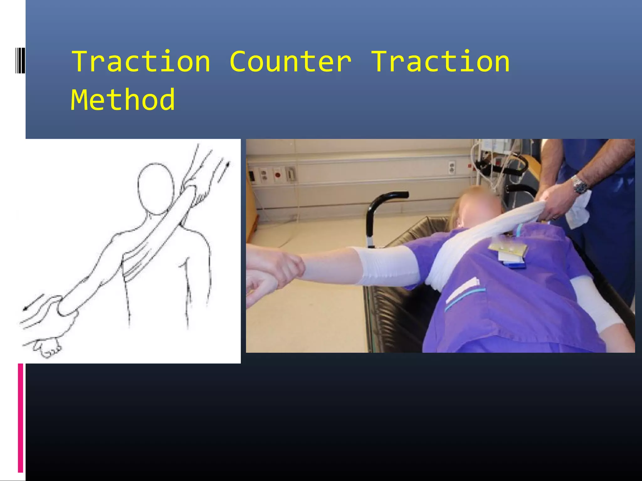 Joint dislocations for medical student | PPT