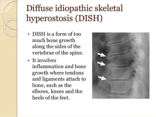 Joint Disorders