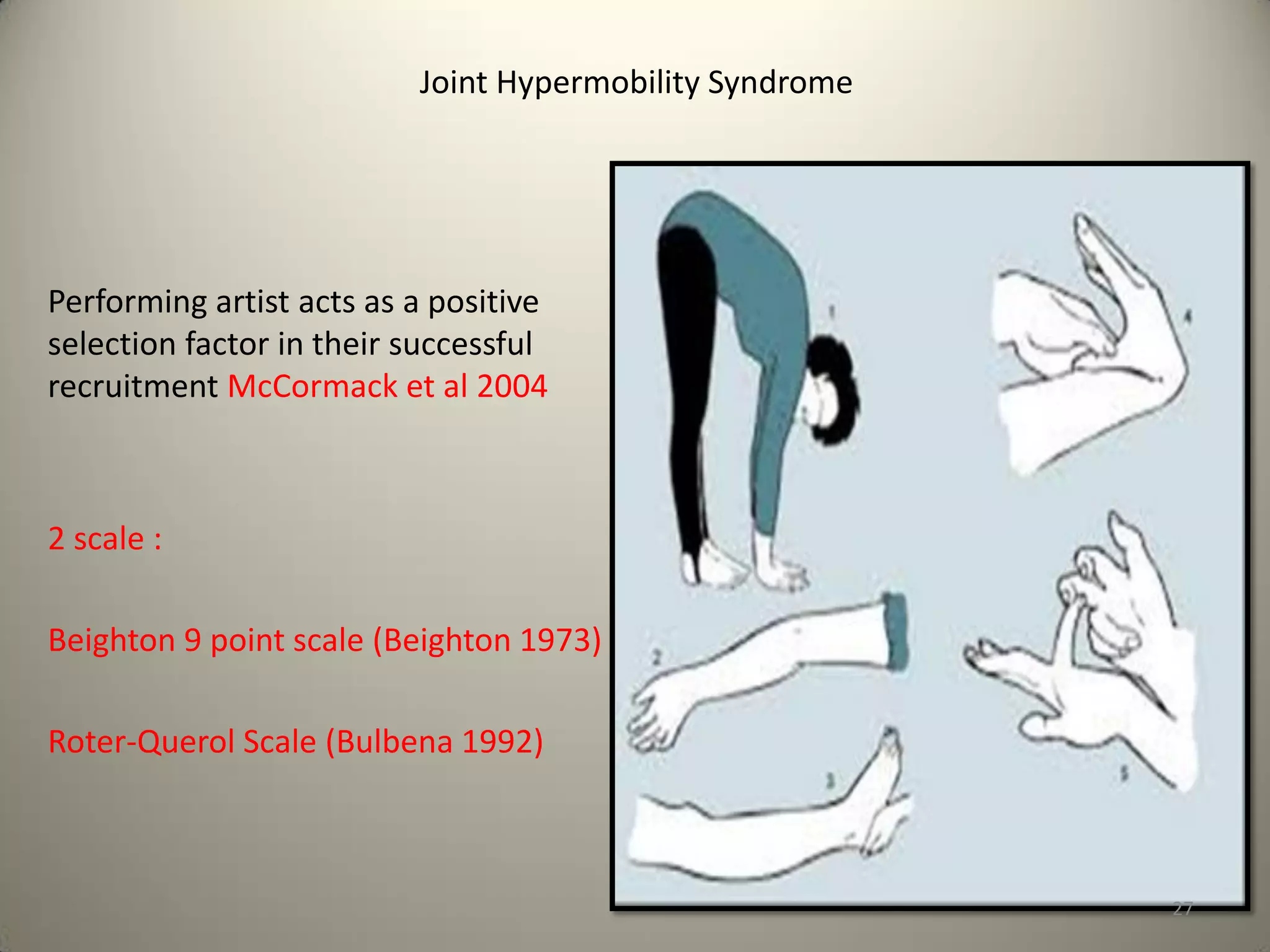 Joint hypermobility presentation 2017 | PPT