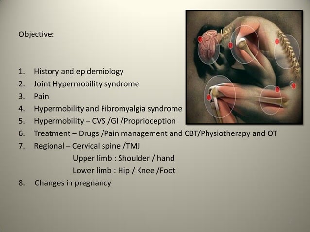 Joint hypermobility presentation 2017 | PPT