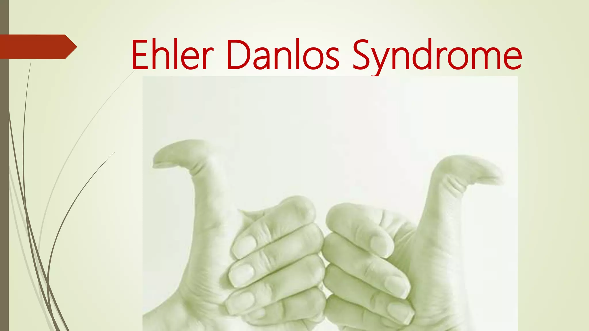 Joint Hyper mobility Syndrome | PPTX