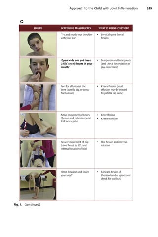 Approach to Arthritis in Children | PDF