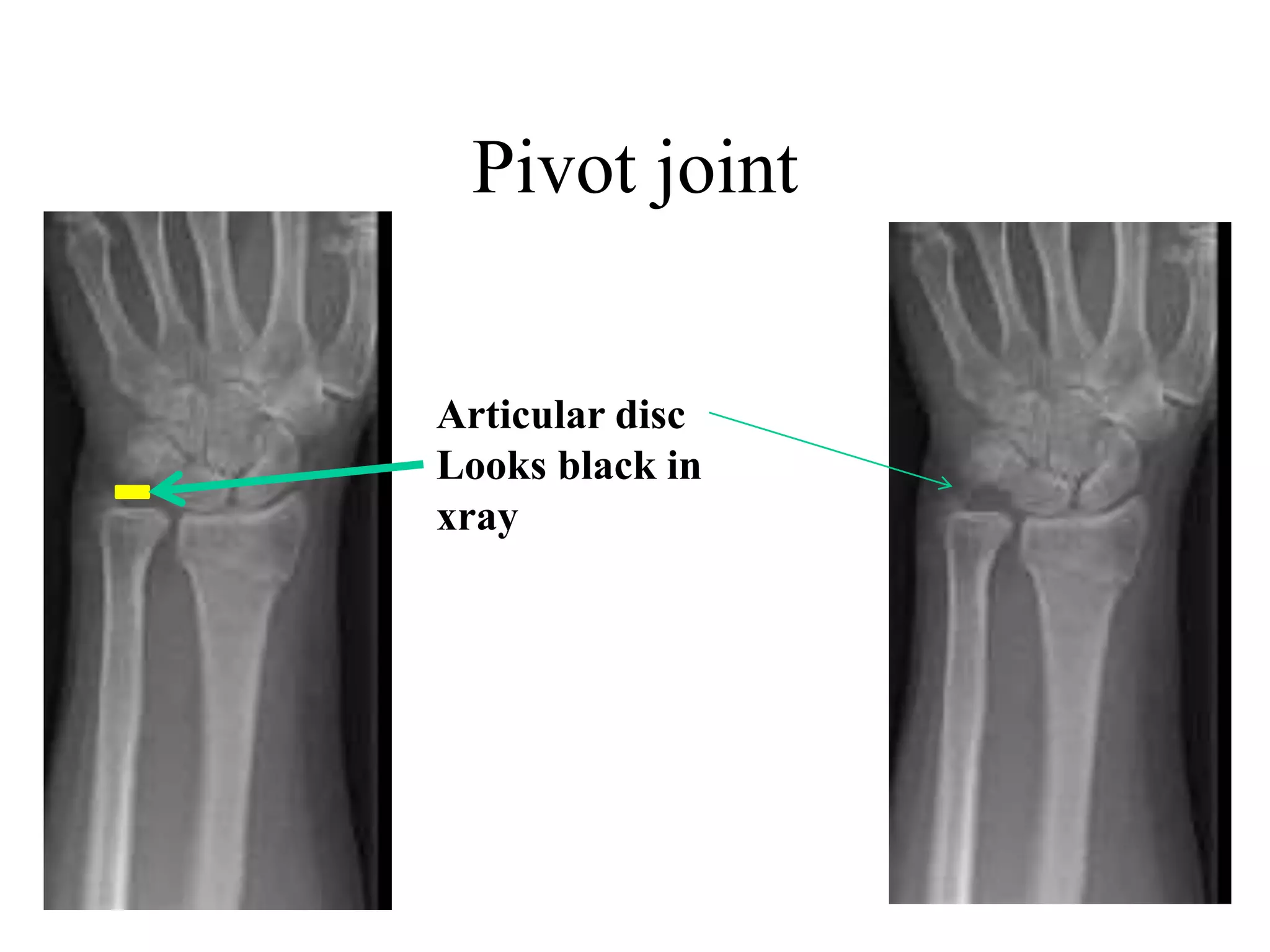 Joint simple description with radiology | PPTX