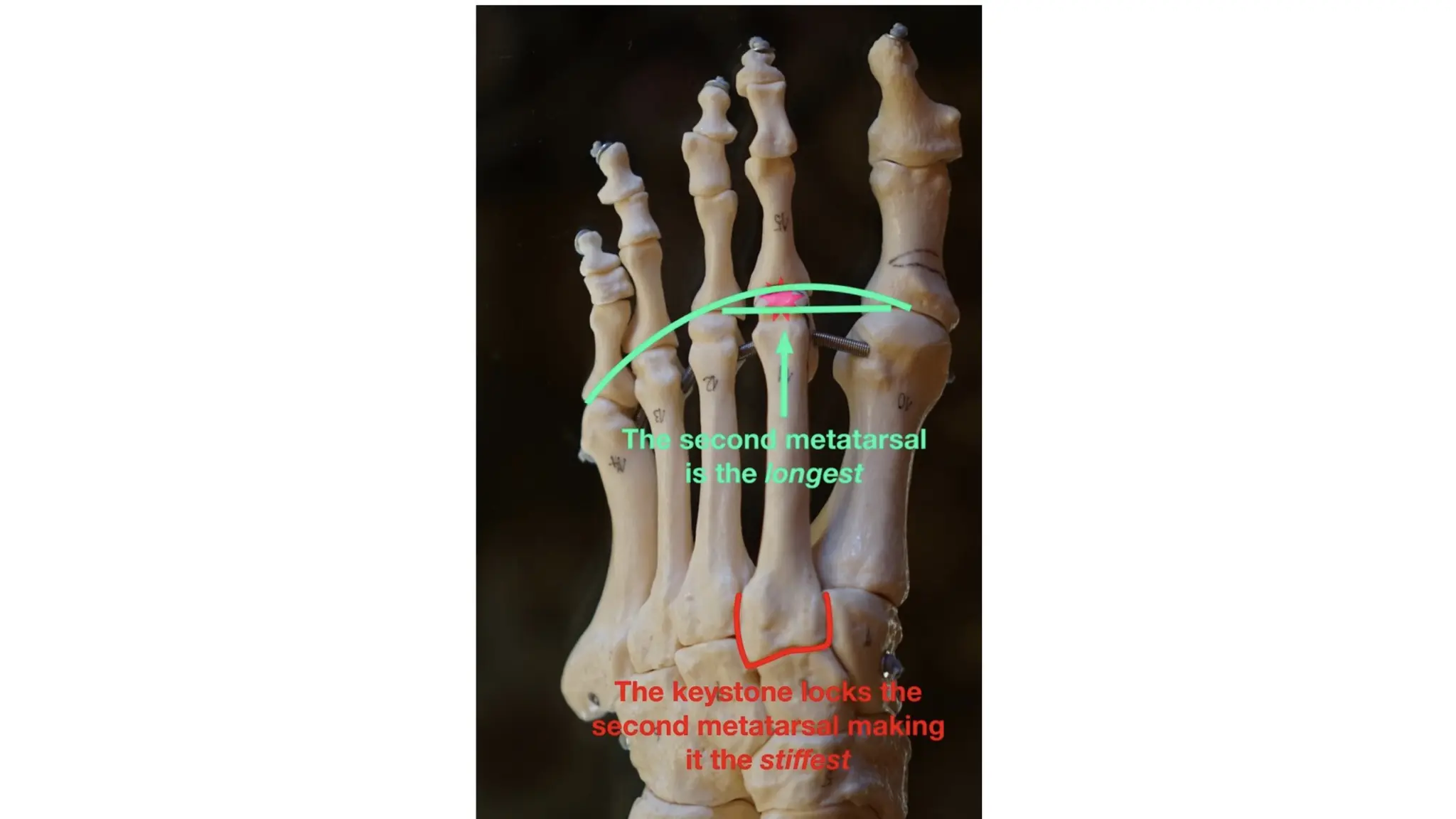 Human anatomy, joints of foot in human anatomy | PPTX