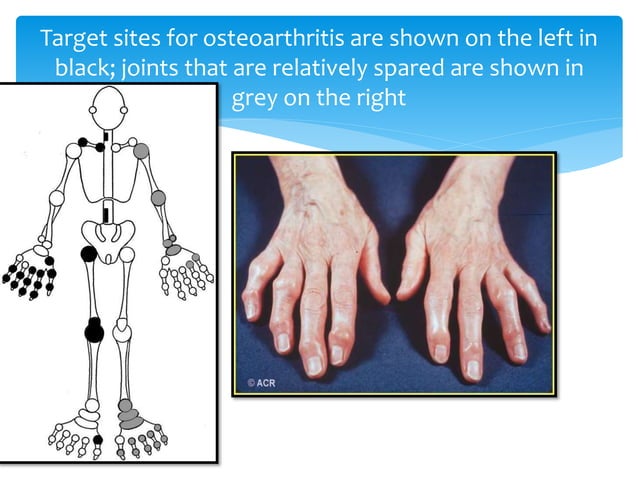 approach to a patient with joint pain.pptx