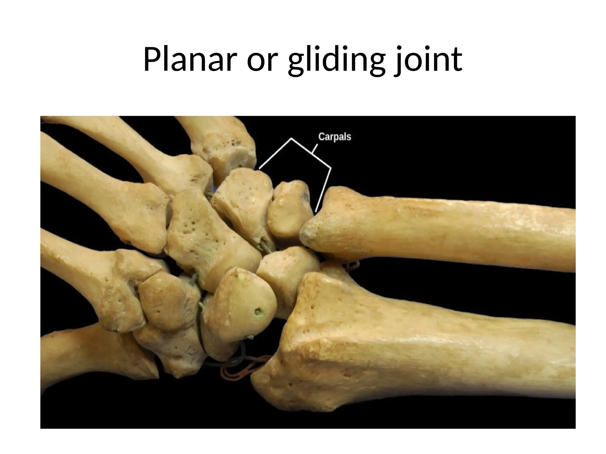 joint ppt.pptx human bone joins ppt 1st prof | PPTX