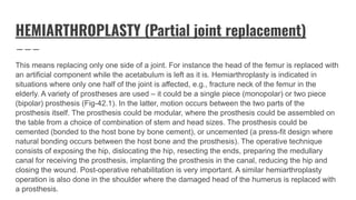 Joint Replacement Surgery in orthopedics.pdf