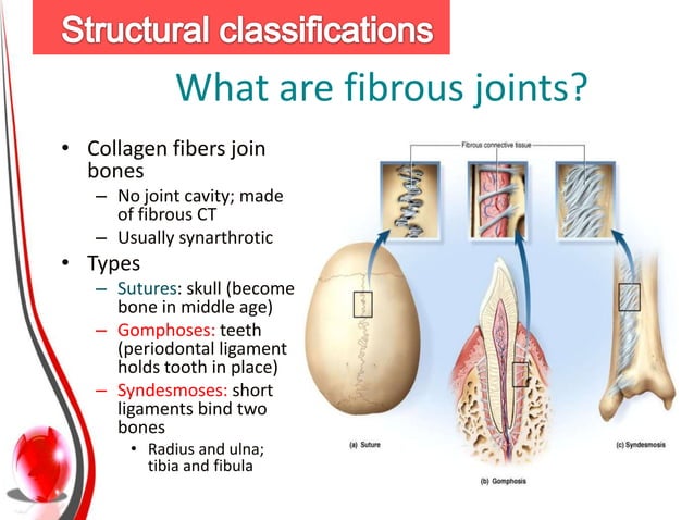 Joints | PPTX | Death, Injury, or Military Conflict | Sensitive Topics