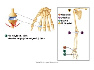 Plane Joint In The Arm