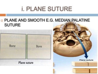 Plane Suture