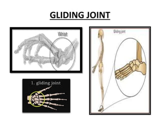 Gliding Joint