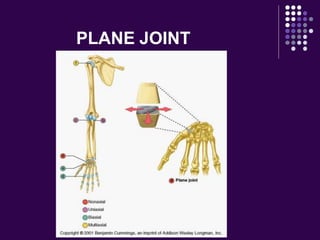 Plane Joint In The Arm