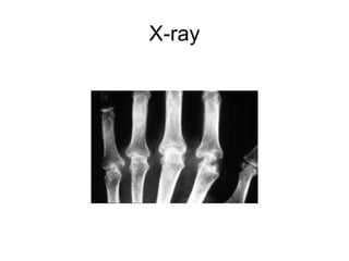 JOINTS.power point of students teachersb | PPT