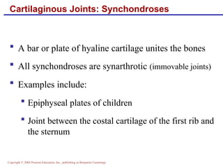 JOINTS.ppt anatomy ..................... | PPT
