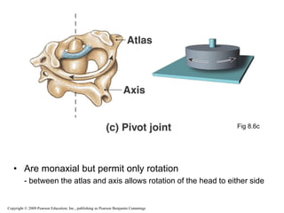 Pivot Joint Atlas And Axis