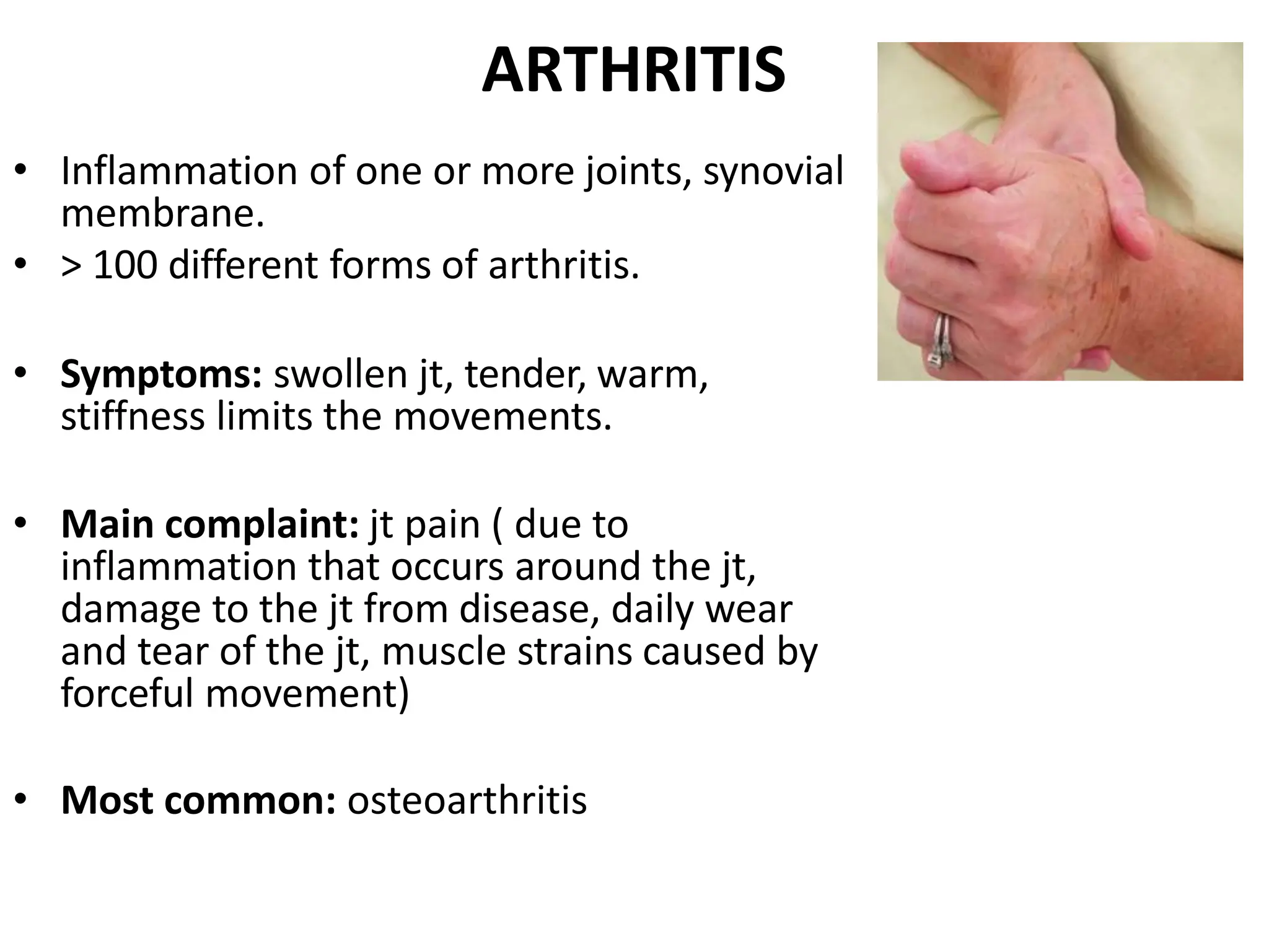 JOINTS ANATOMY .anatomy of joint pptx... | PPTX
