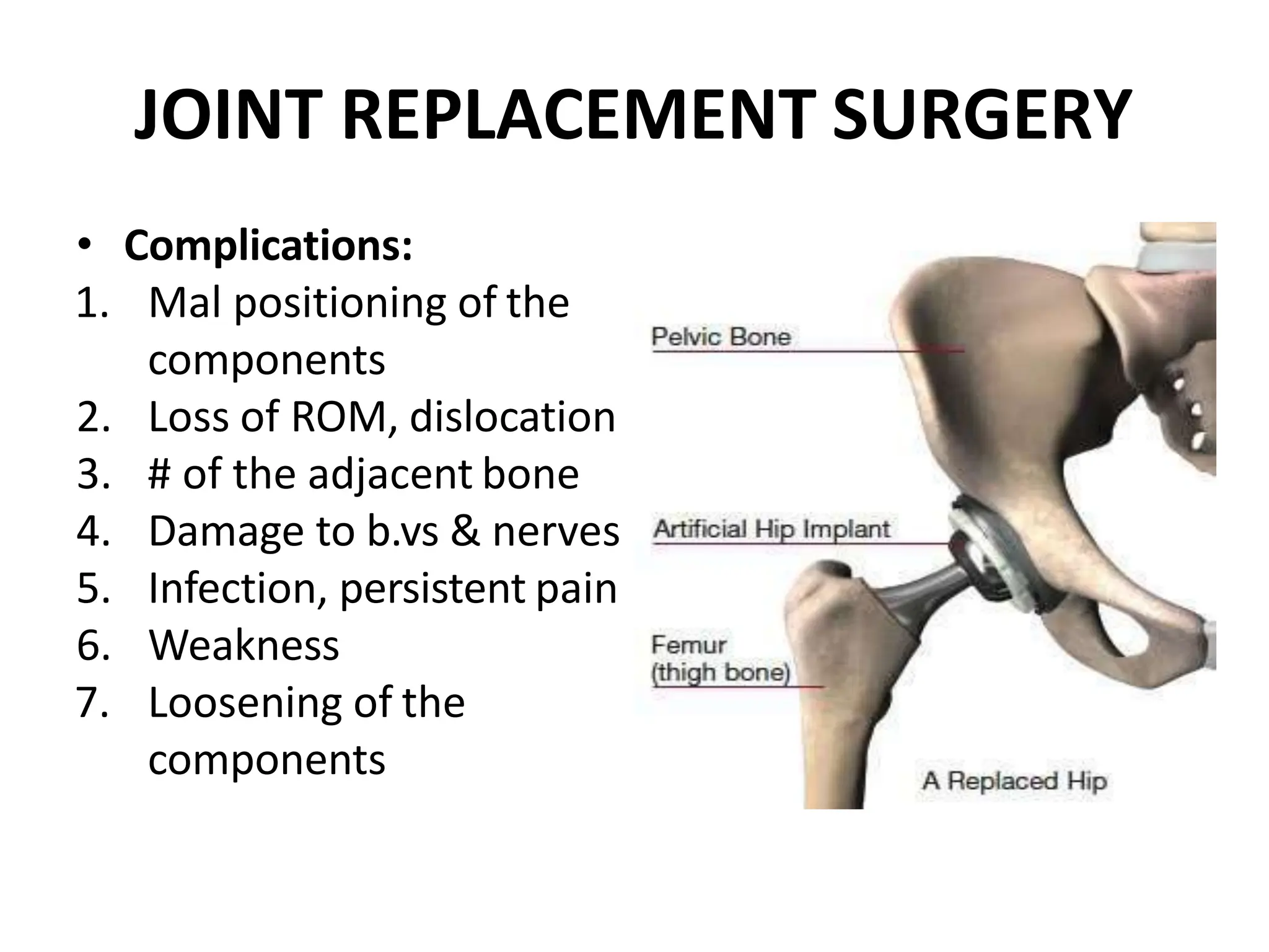 JOINTS ANATOMY .anatomy of joint pptx... | PPTX