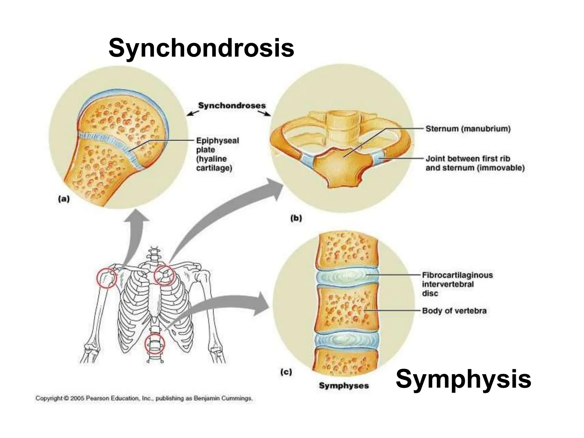 joints and its classification different types of joints .pptx | Death ...