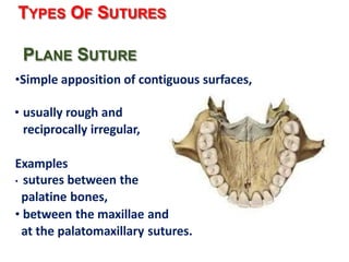 joints and its classification different types of joints .pptx