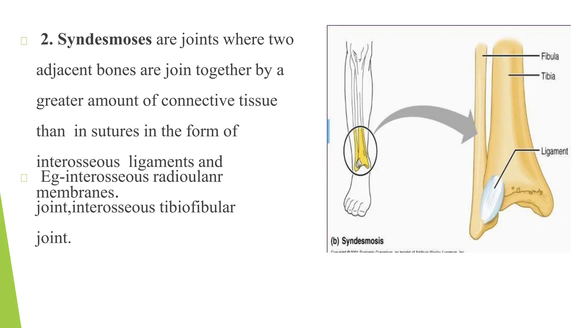 JOINTS CLASSIFICATION AND DISORDERS.pptx