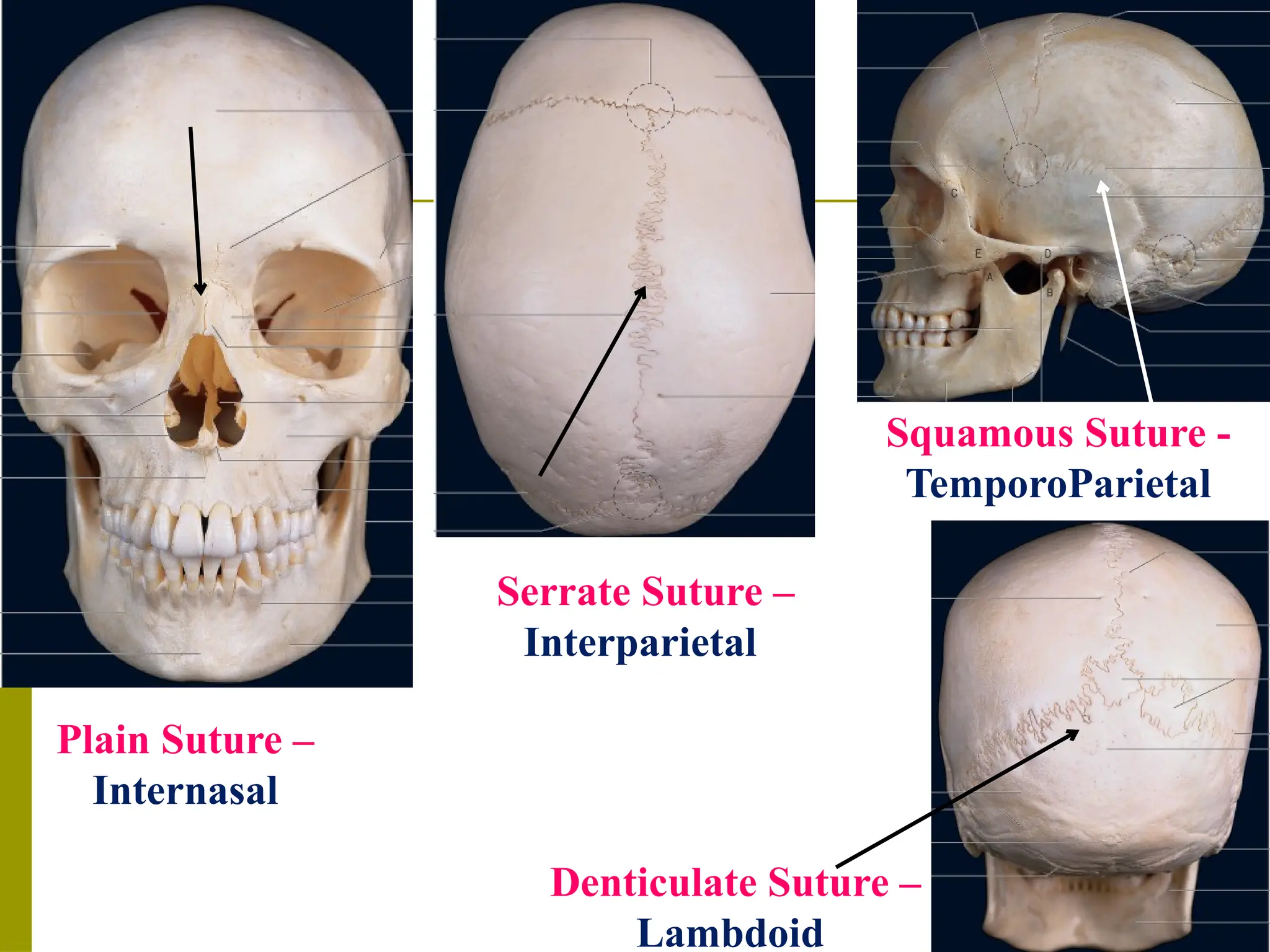 joints general anatomy of human body and | PPTX