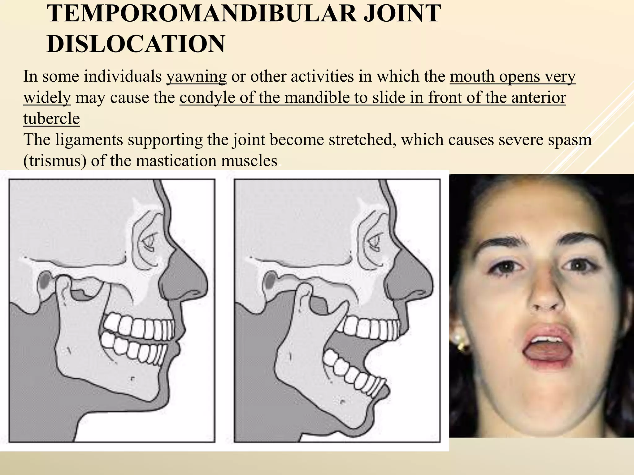 Joints of the SKULL.pptx