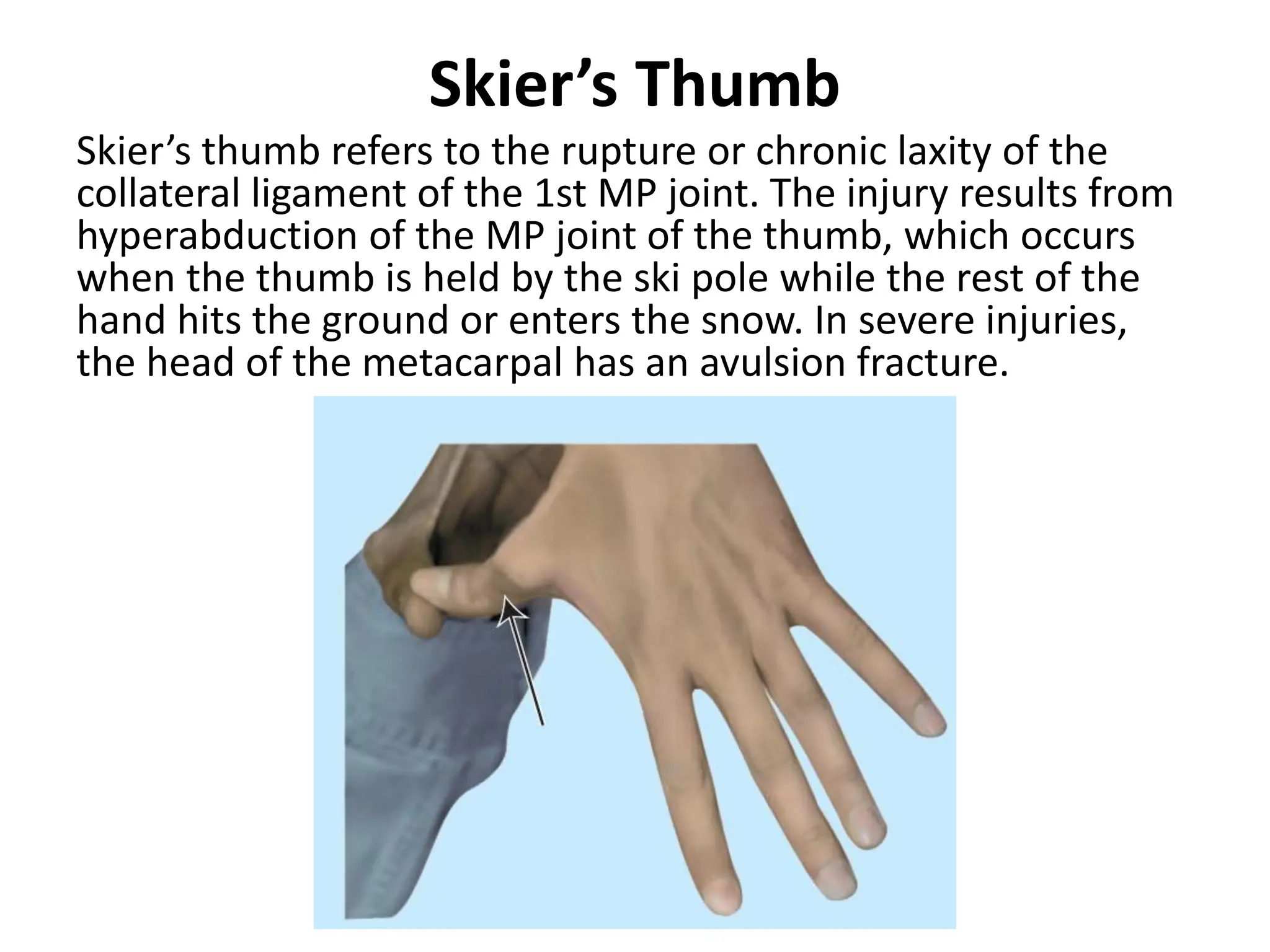 joints of upper limbs human anatomy best slides | PDF