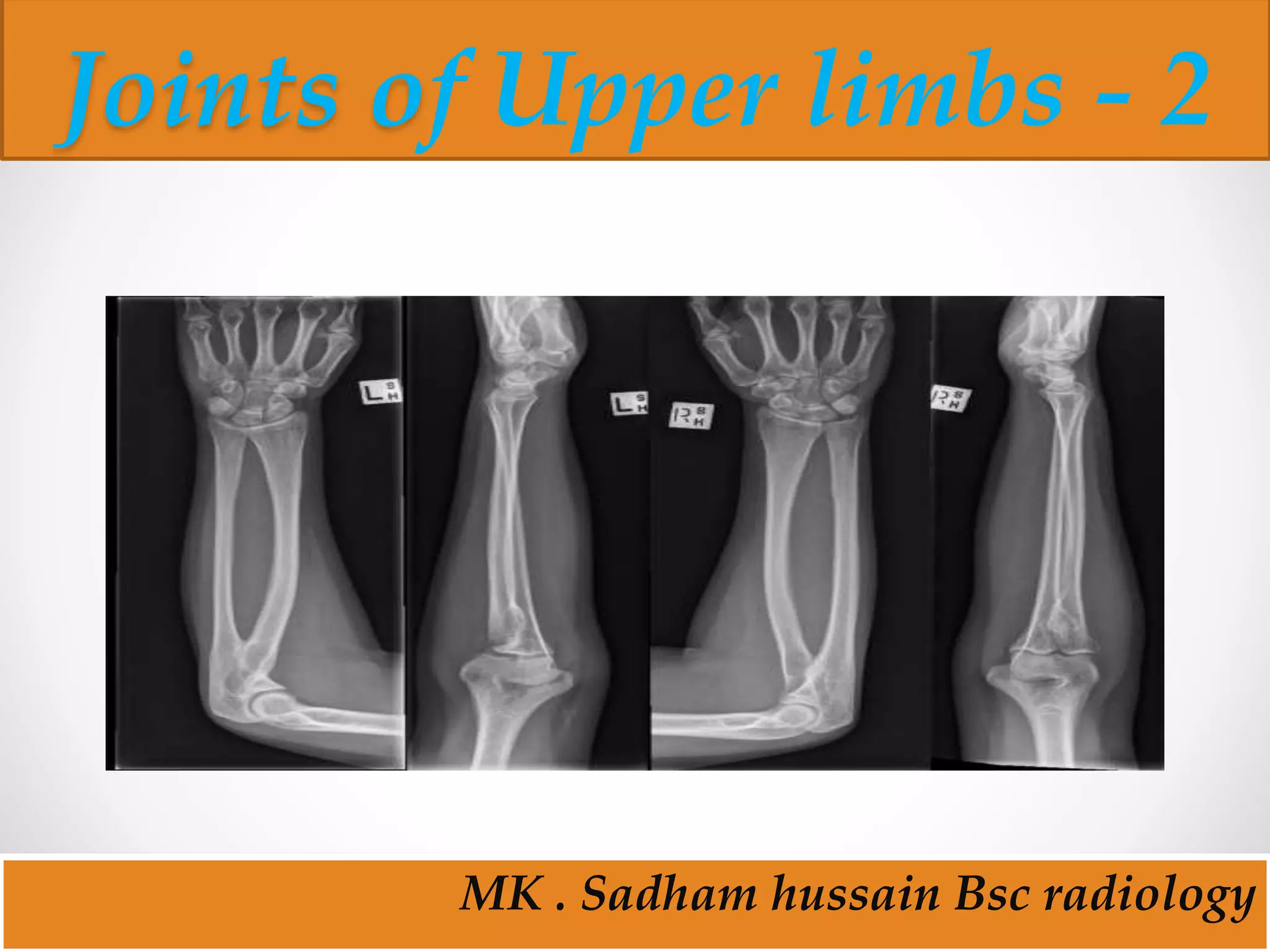 Radiology Anatomy Of Upper Limb Pptx Powerpoint