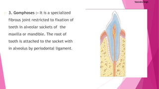 Joints, Classification and Disorder | PPT